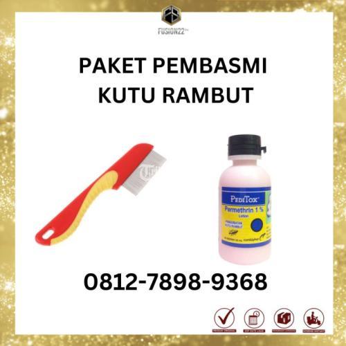 Peditox Obat Kutu Rambut Ampuh Harga Murah di Surabaya - Tribun JualBeli