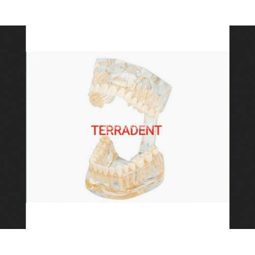 Dental Study Model Phantom Gigi Bisa di Lepas Transparan di Jakarta ...