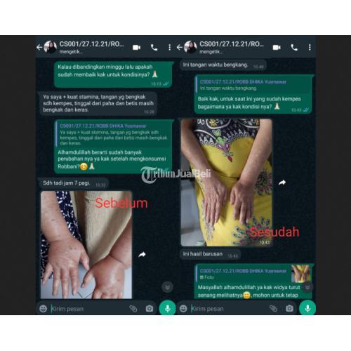 Robbani obat kolesterol dan asam urat nyeri sendi diabetes kencing ...