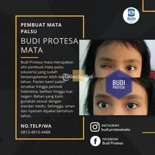 Pembuat Mata Palsu Protesa Mata Bergaransi di Semarang - Tribun JualBeli