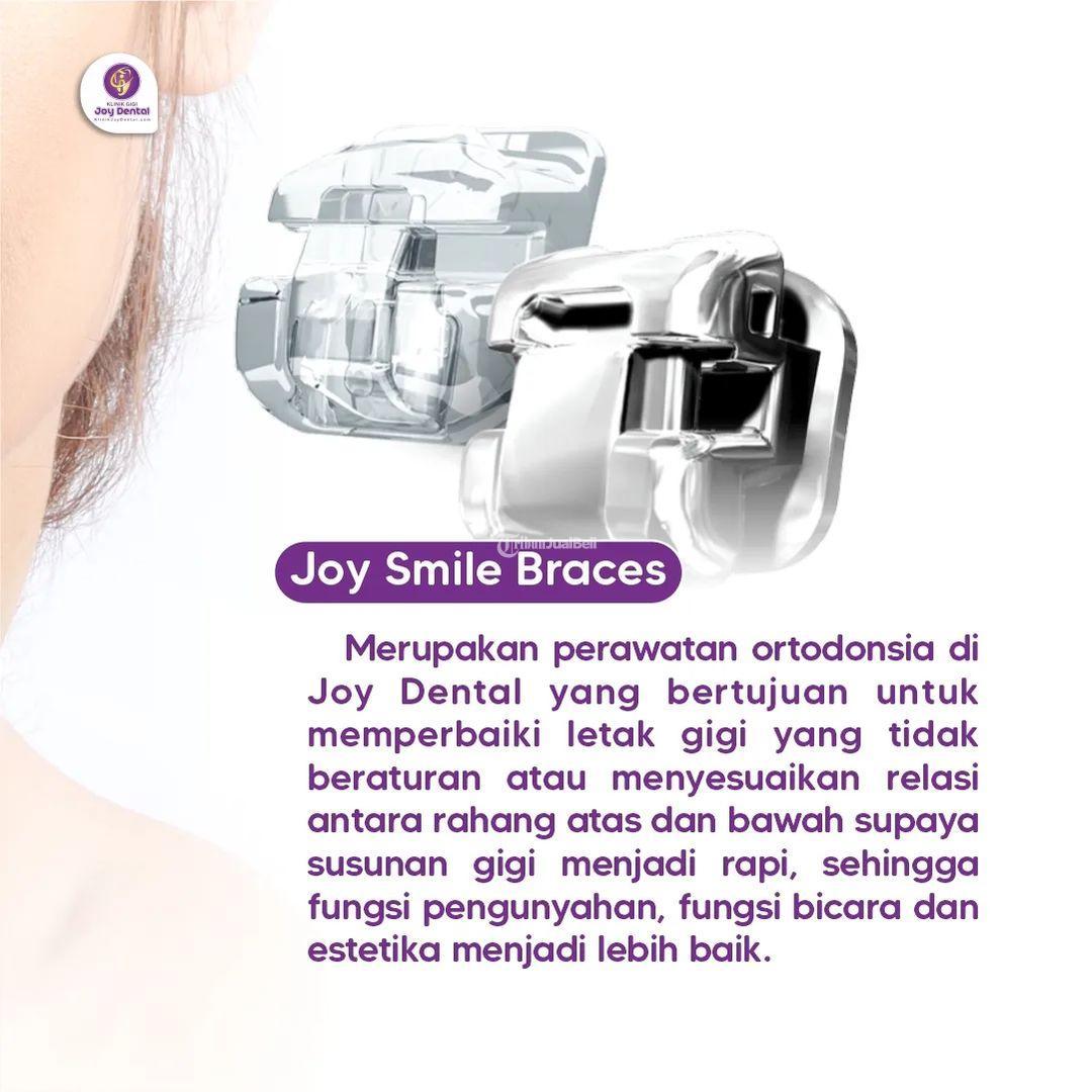 Klinik Gigi Joy Dental Konsultasi Pasang Behel Atau Pasang Kawat Gigi ... Klinik Gigi Joy Dental Konsultasi Pasang Behel Atau Pasang Kawat Gigi ...