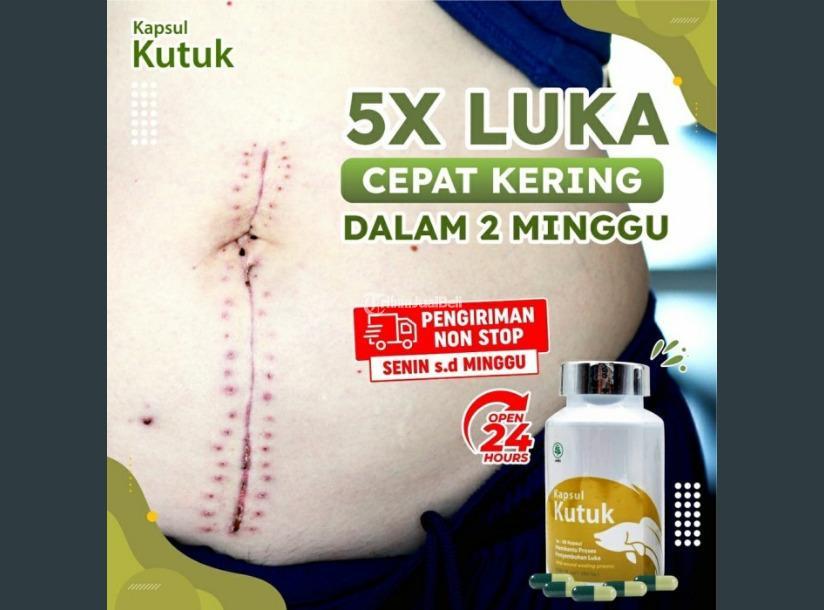 Kapsul Kutuk Premium Original Pil Ikan Gabus Obat Setelah Operasi di ...