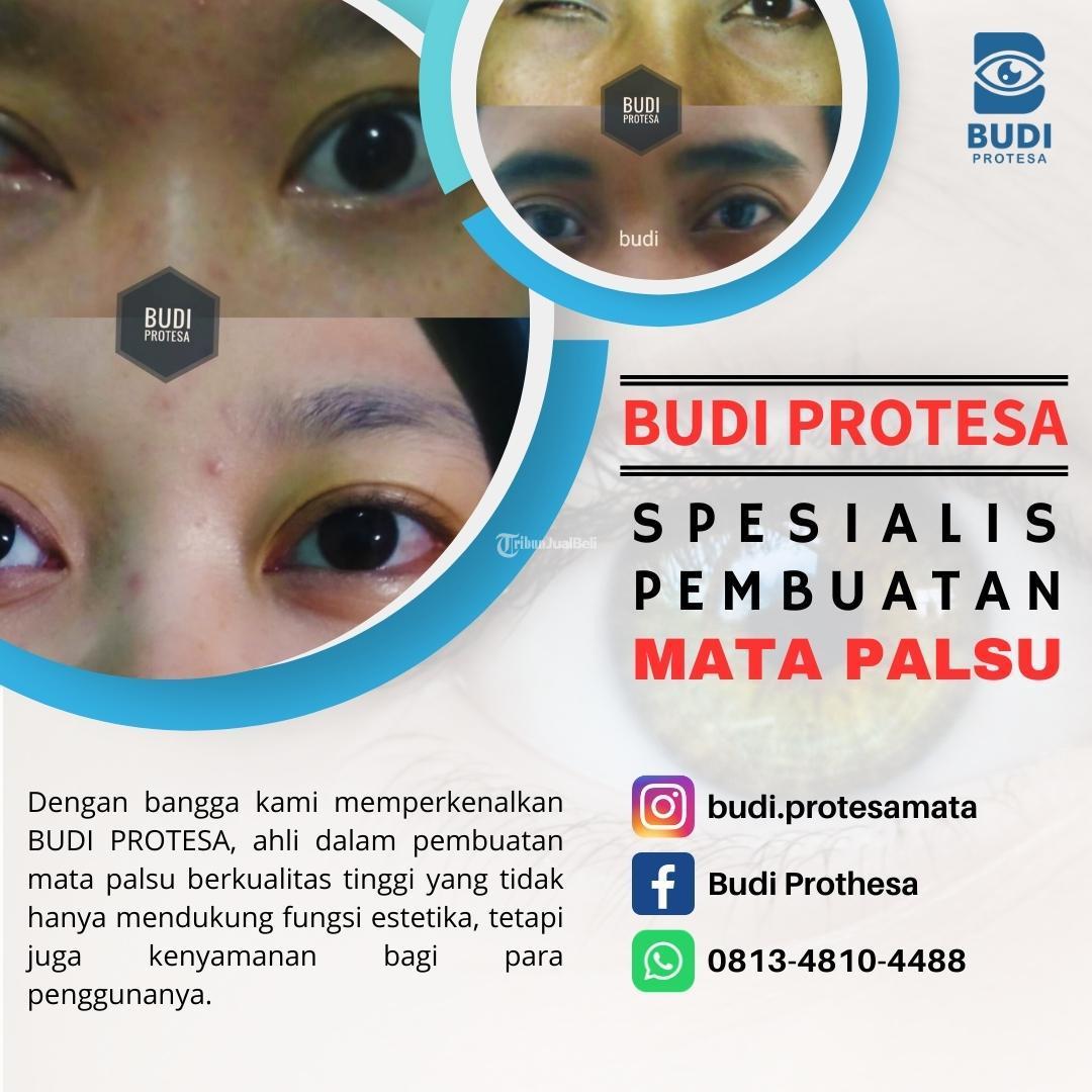 Terpercaya Budi Protesa Pembuat Protesa Mata Palsu Prostetik di ...