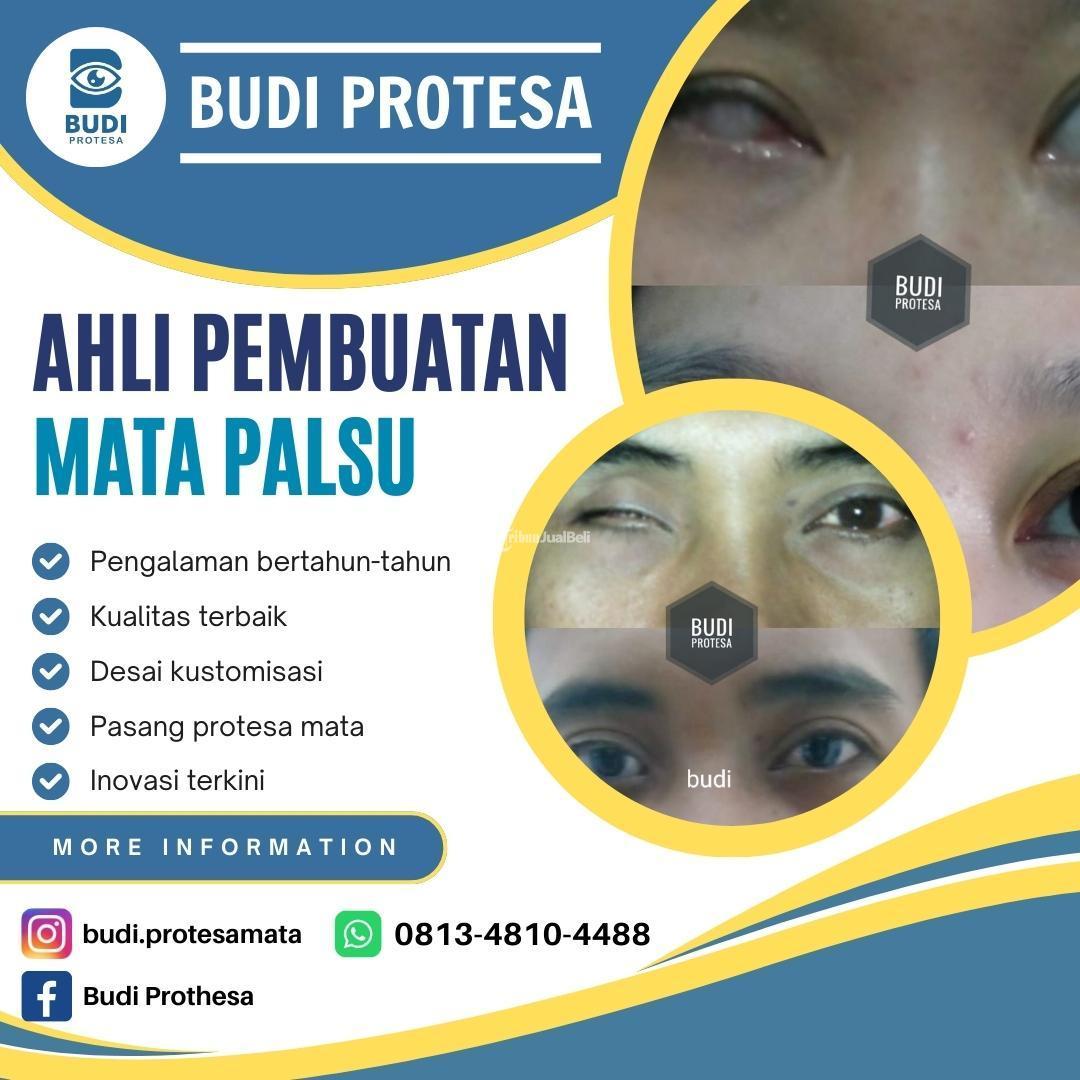 Terpercaya Budi Protesa Pembuat Protesa Mata Palsu Prostetik di ...