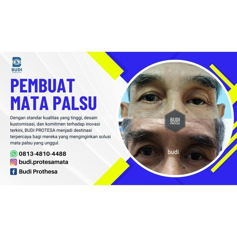 Pembuat Protesa Mata Palsu di Malang - Tribun JualBeli