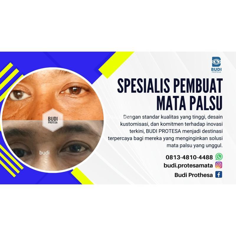 Pembuat Protesa Mata Palsu di Malang - Tribun JualBeli