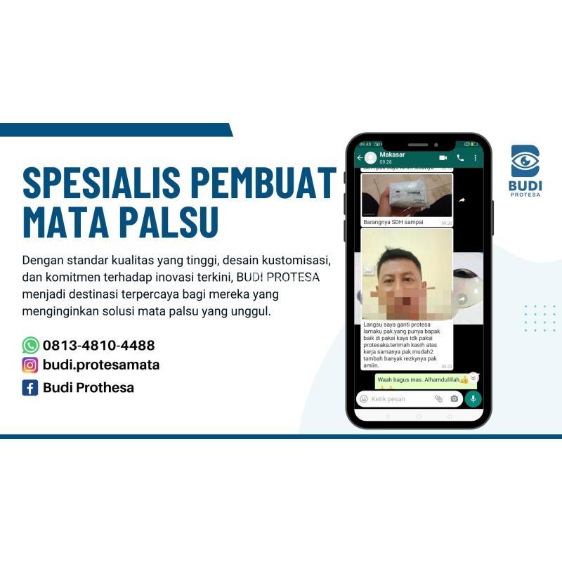 Pembuat Protesa Mata Palsu di Malang - Tribun JualBeli