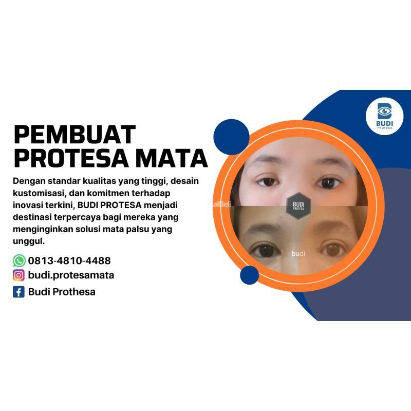 Pembuat Protesa Mata Palsu di Surakarta - Tribun JualBeli