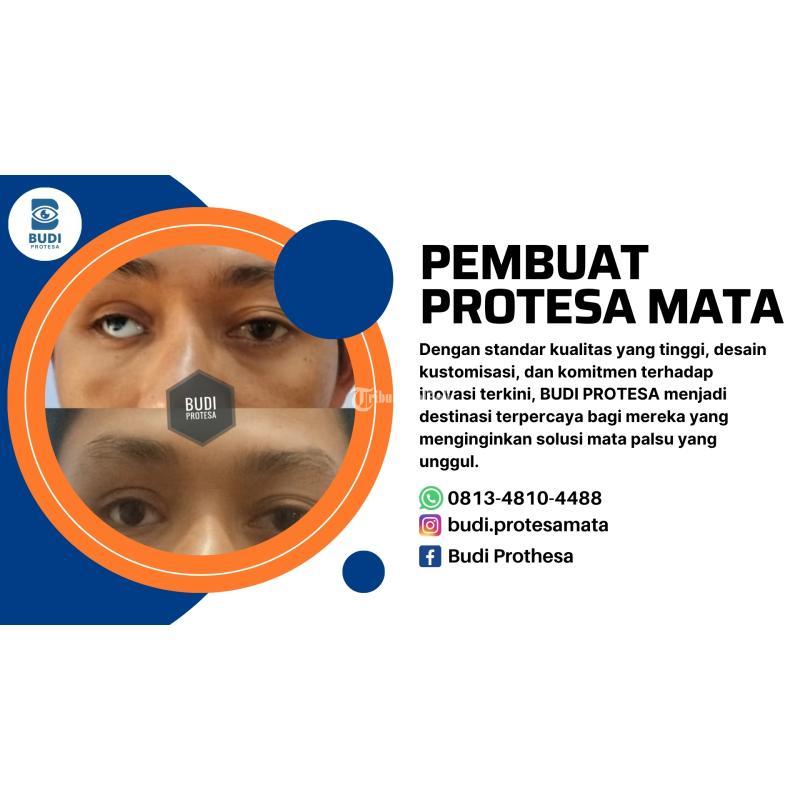 Pembuat Protesa Mata Palsu di Surakarta - Tribun JualBeli