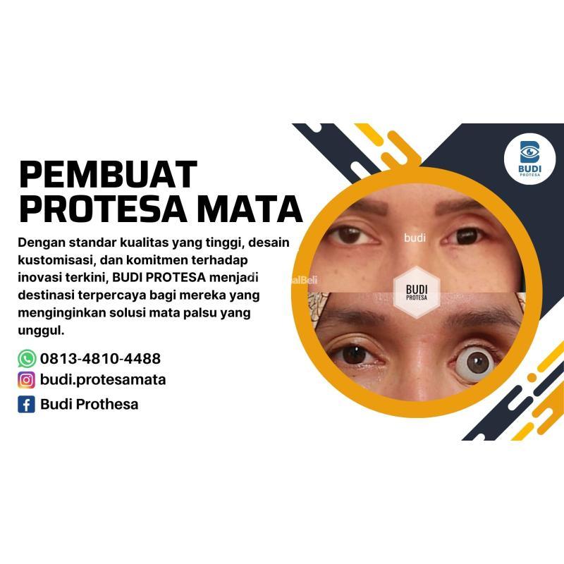 Terpercaya Budi Protesa Pembuat Mata Palsu di Surakarta - Tribun JualBeli