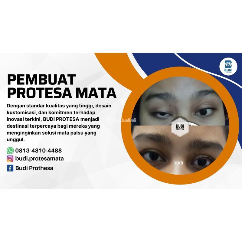 Terpercaya Budi Protesa Pembuat Mata Palsu di Surakarta - Tribun JualBeli