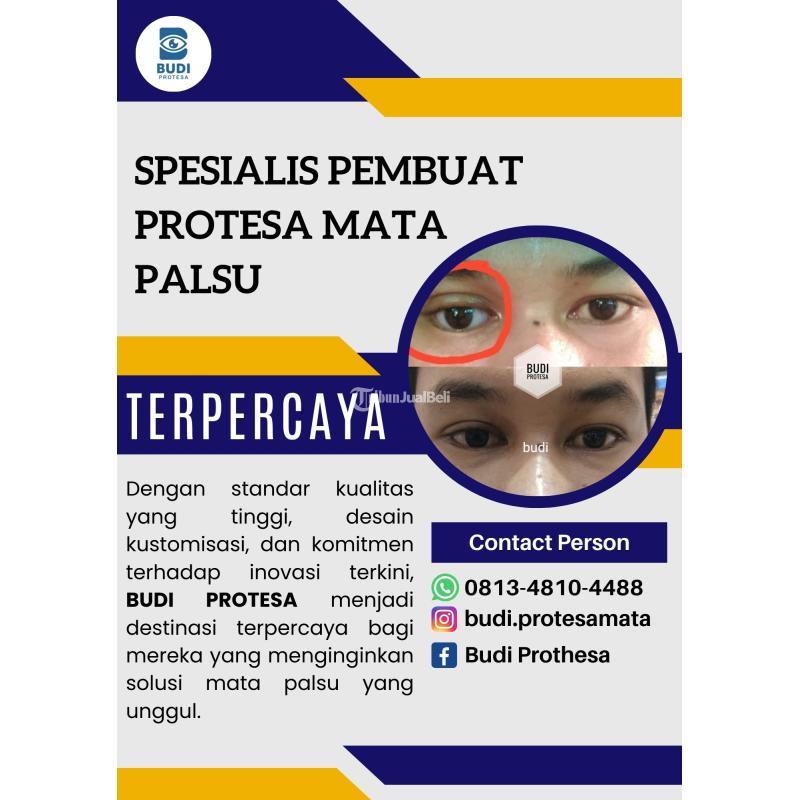 TERPERCAYA BUDI PROTESA, Pembuat Protesa Mata Palsu di Bogor, Pasang ...