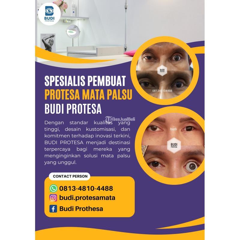 TERPERCAYA BUDI PROTESA, Pembuat Protesa Mata Palsu di Bogor, Pasang ...