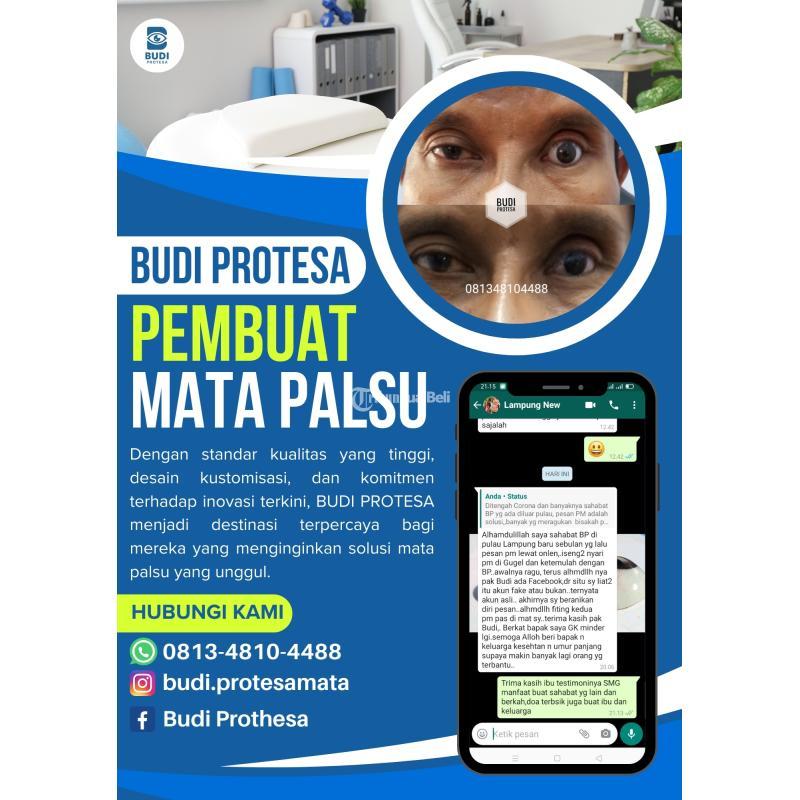 TERPERCAYA BUDI PROTESA, Pembuat Protesa Mata Palsu di Bogor, Pasang ...