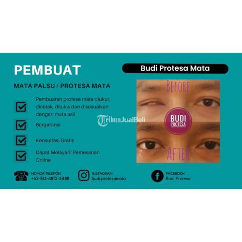Pembuat Mata Palsu di Solo, Pembuat Protesa Mata Bergaransi di ...