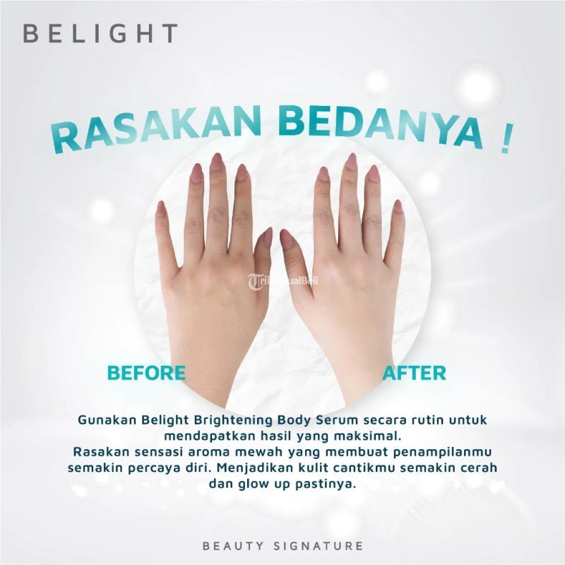 Belight Body Lotion Mencerahkan dan Melembapkan Kulit Kusam dengan ...