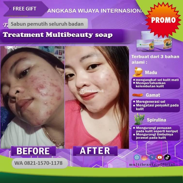 Sabun Jerawat Ampuh Merk Multibeauty di Blitar Jawa Timur - Tribun JualBeli