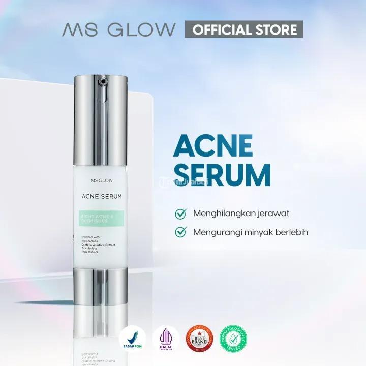 Acne serum ms glow store