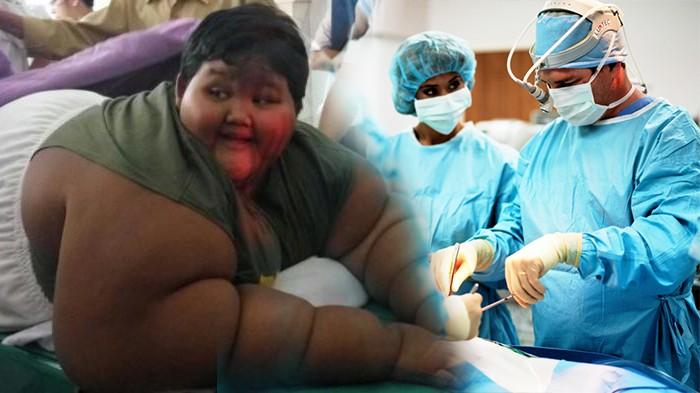 Mengenal Metode dan Efek Samping Operasi Bariatrik yang Bantu Arya ...