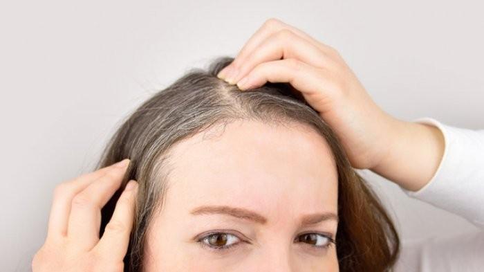 Tak Banyak yang Tahu, Ternyata Inilah 6 Penyebab Munculnya Uban di Usia Muda - Blog ...